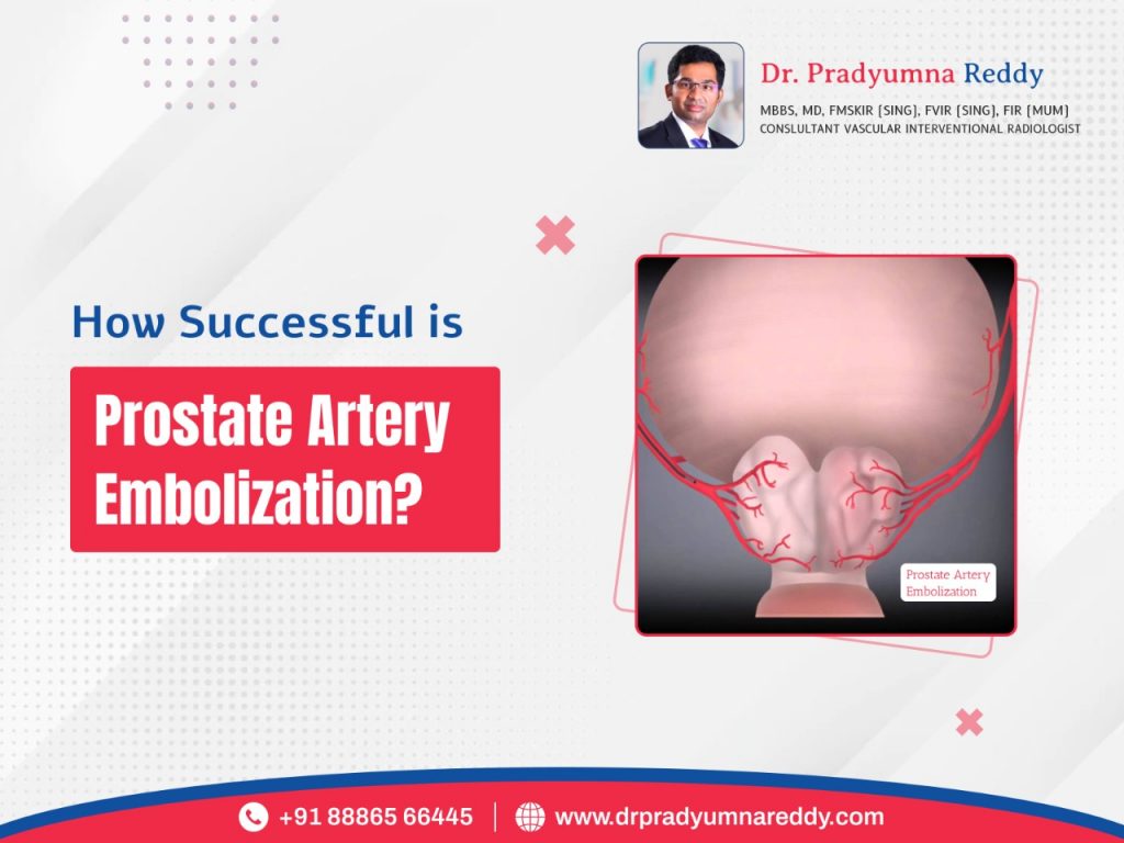 How Successful is Prostate Artery Embolization? - Dr Pradyumna Reddy